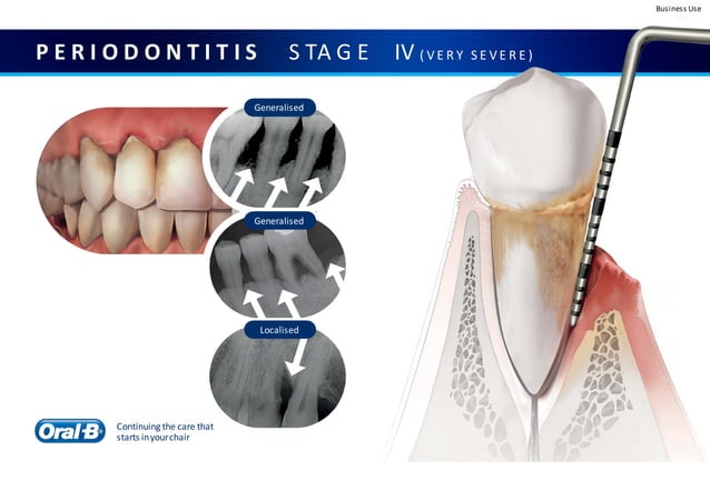 OralB_Patient_Guide_Flipchart final.pdf