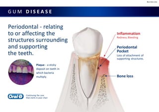 OralB_Patient_Guide_Flipchart final.pdf