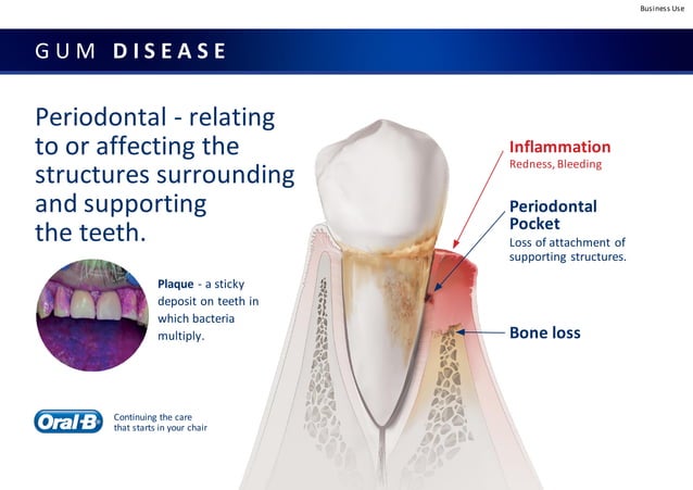 OralB_Patient_Guide_Flipchart final.pdf