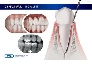 OralB_Patient_Guide_Flipchart final.pdf