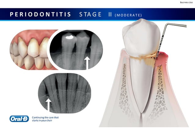 OralB_Patient_Guide_Flipchart final.pdf
