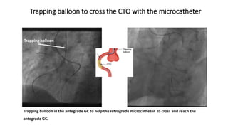 Nicolas Boudou: Externalisation Failure – What next? | PPT