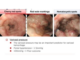 Varices esofagicas | PPT
