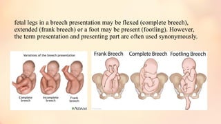 1056_Fetus_in_uterus.pdf1056_Fetus_in_uterus.pdf 1 | PDF