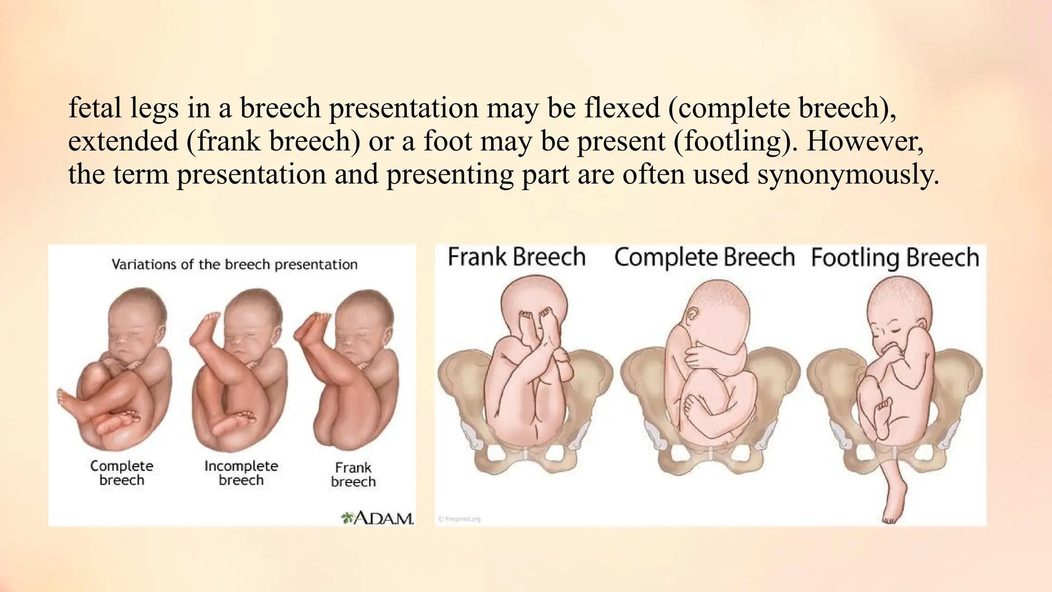 Feto pelvic relationship lie position ppt | PPTX