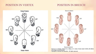 Feto pelvic relationship lie position ppt | PPT