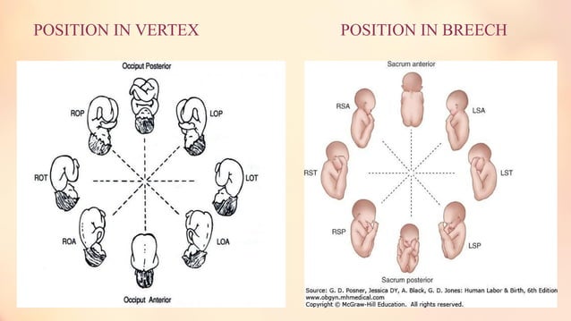 Feto pelvic relationship lie position ppt | PPT