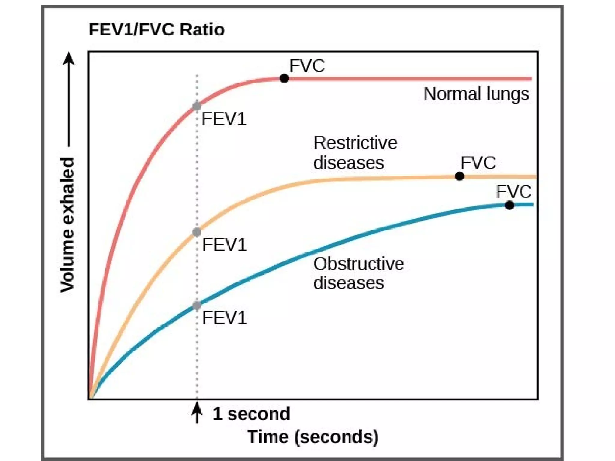 CHRONIC OBSTRUCTIVE PULMONARY DISEASES (COPD) | PPT