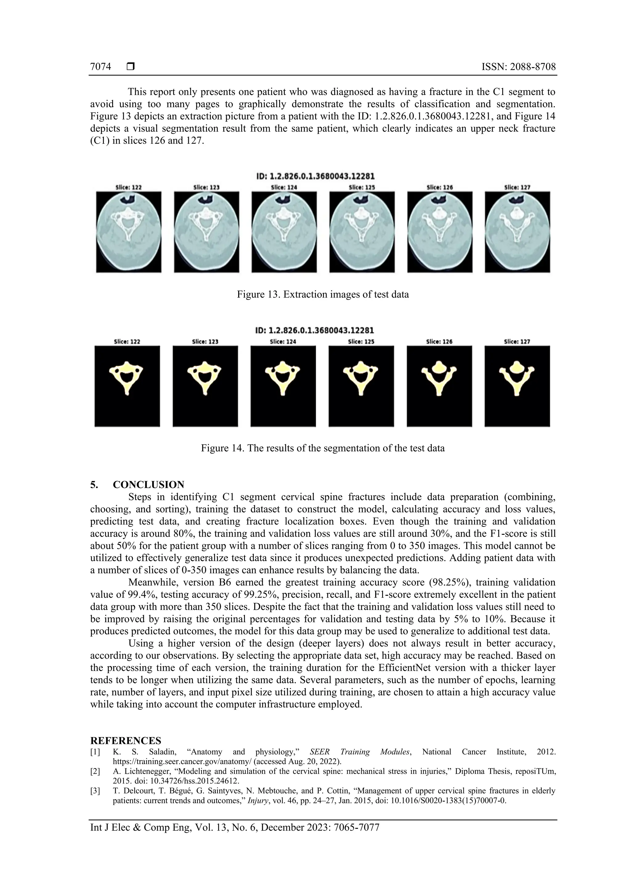 Classification of cervical spine fractures using 8 variants EfficientNet with transfer learning ...