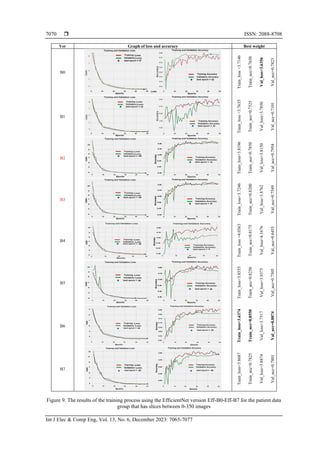 Classification of cervical spine fractures using 8 variants EfficientNet with transfer learning ...