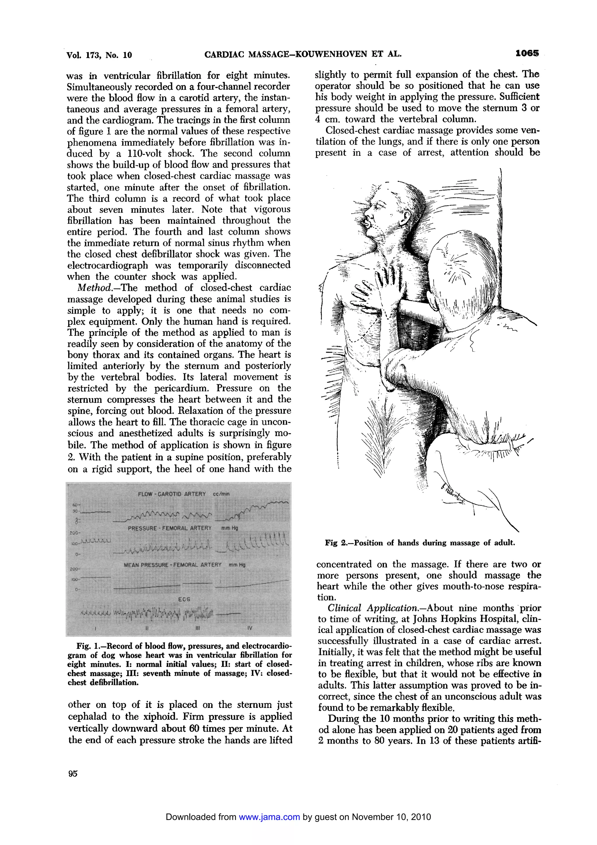 CLOSED-CHEST CARDIAC MASSAGE | PDF