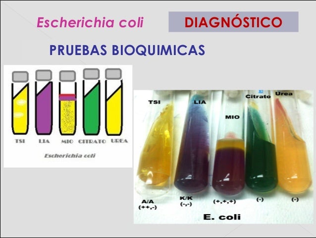 107. pw e coli-2016_uc