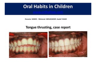 107 oral habits in children tongue thrusting-mohamad aboualnaser-awatef ...