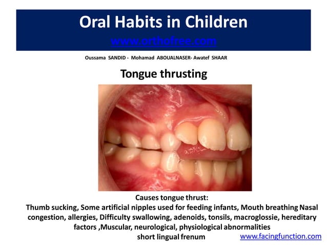 107 oral habits in children tongue thrusting-mohamad aboualnaser-awatef ...