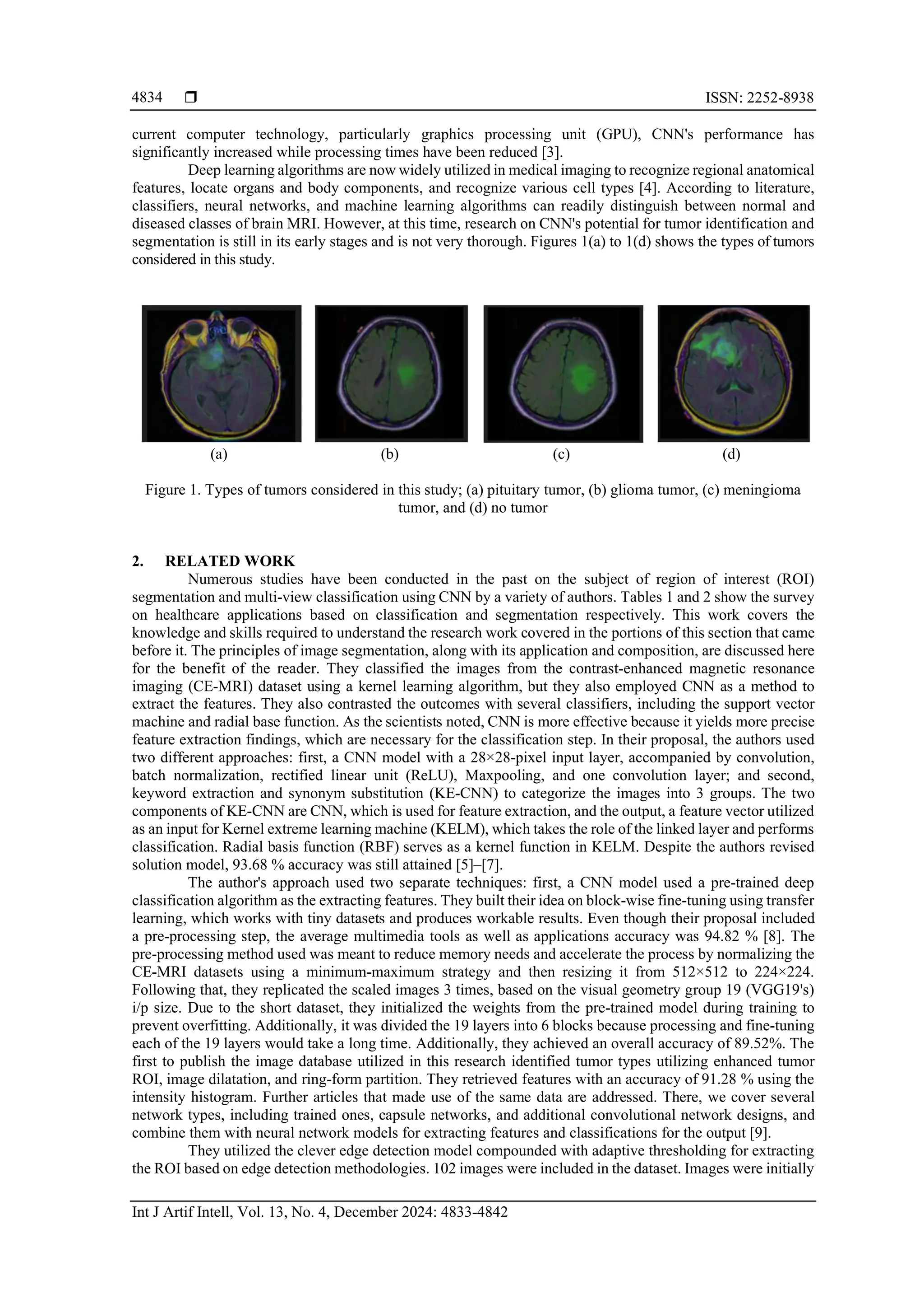 Automated diagnosis of brain tumor classification and segmentation of magnetic resonance imaging ...