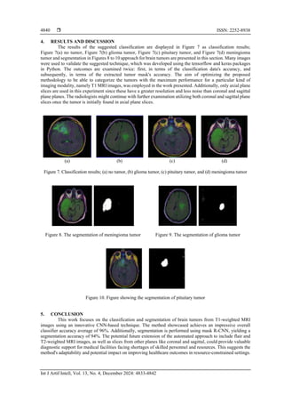 Automated diagnosis of brain tumor classification and segmentation of magnetic resonance imaging ...