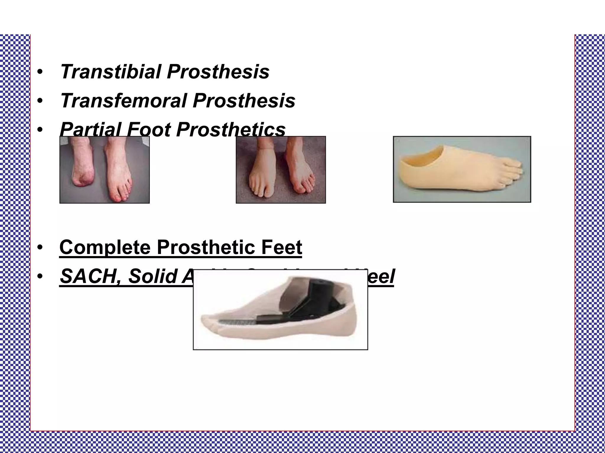 107493_Lower Limb Pro..PPT
