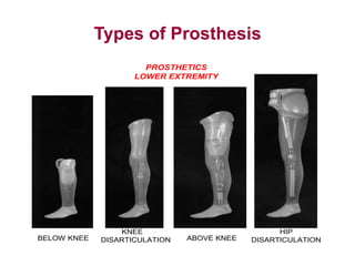 107493_Lower Limb Pro..PPT