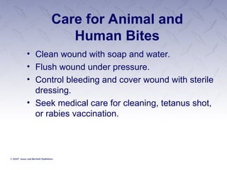 Animal and Human Bites WITH bITE INVESTIGATIONS | PPT