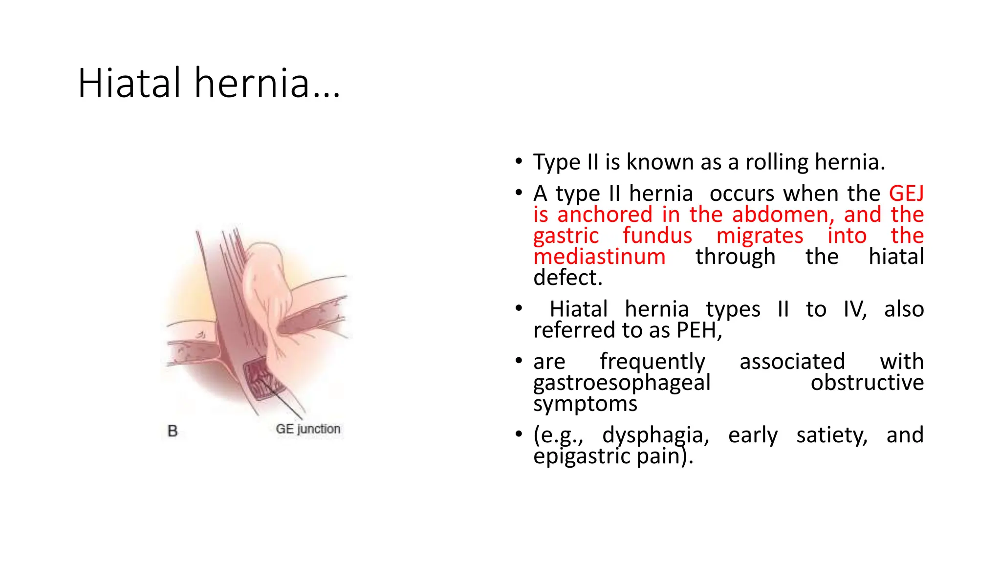 Gastro esophageal reflux disease (GERD).pptx
