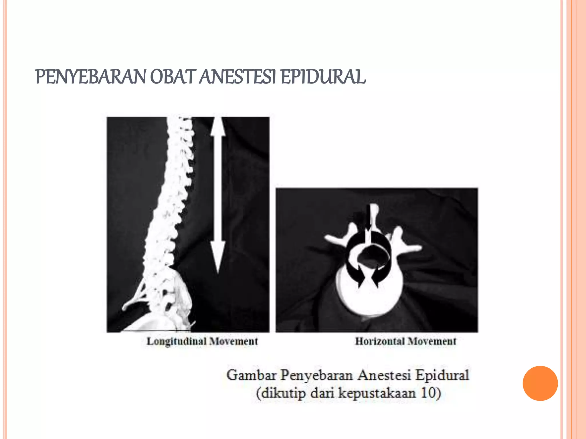 108822053-Epidural-Anestesi.ppt
