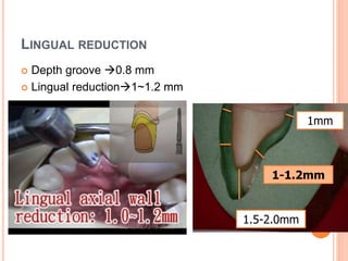 Tooth Preparation.pptx