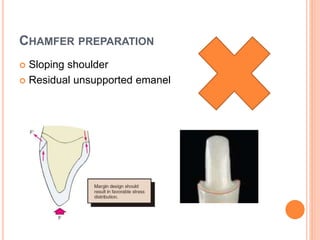 Tooth Preparation.pptx