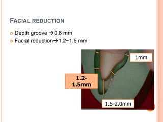 Tooth Preparation.pptx