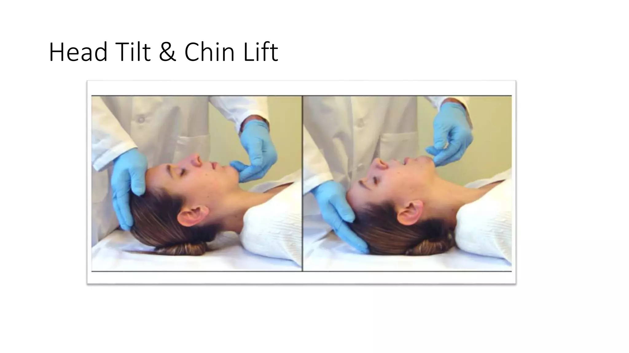 1090_basic-airway-managment.pptx