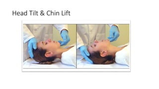 1090_basic-airway-managment.pptx