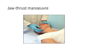 1090_basic-airway-managment.pptx