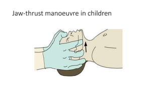 1090_basic-airway-managment.pptx