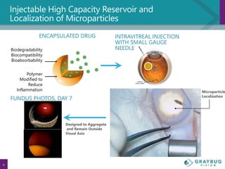 RETINA COMPANY SHOWCASE - Graybug Vision | PPTX