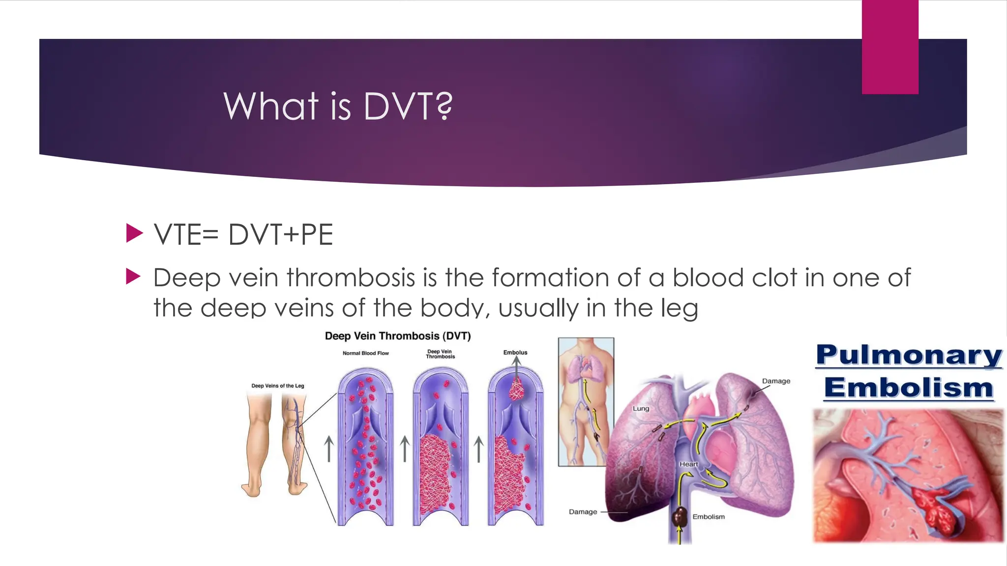 1091_DVT-Prophylaxis-in-Neuro-ICU-1-2.ppt