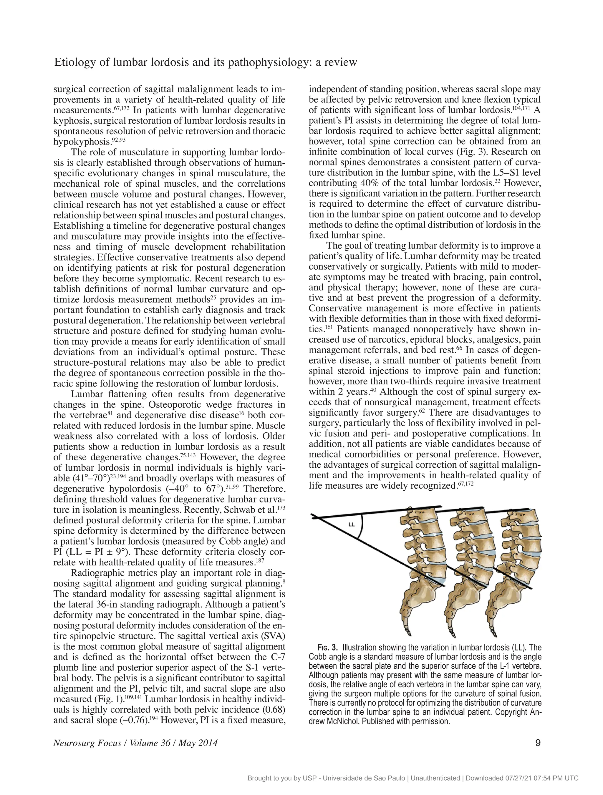 [10920684 - Neurosurgical Focus] Etiology of lumbar lordosis and its pathophysiology_ a review ...