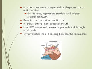 1092_Endotracheal-Intubation.pptx | Ear, Nose and Throat Conditions ...