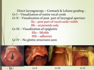 Endotracheal-Intubation is a procedure to save the human life from any ...