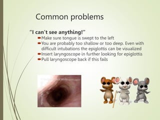 Endotracheal-Intubation procedure very important and essential ...