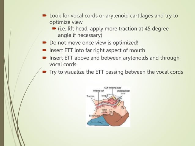 Endotracheal-Intubation procedure very important and essential ...