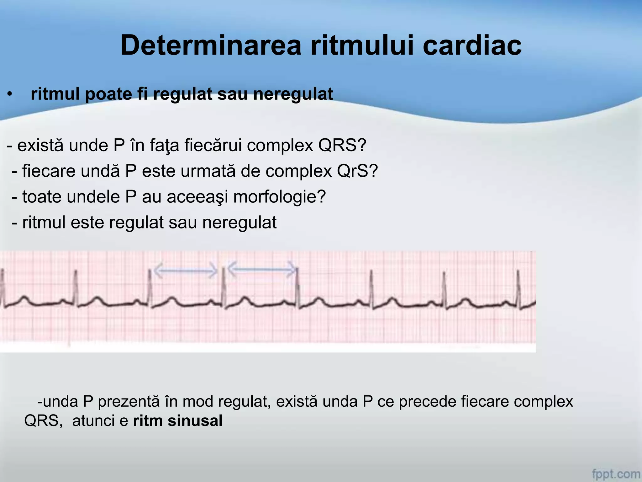 1094029 ekg interpretare.-hipertofia | PPT