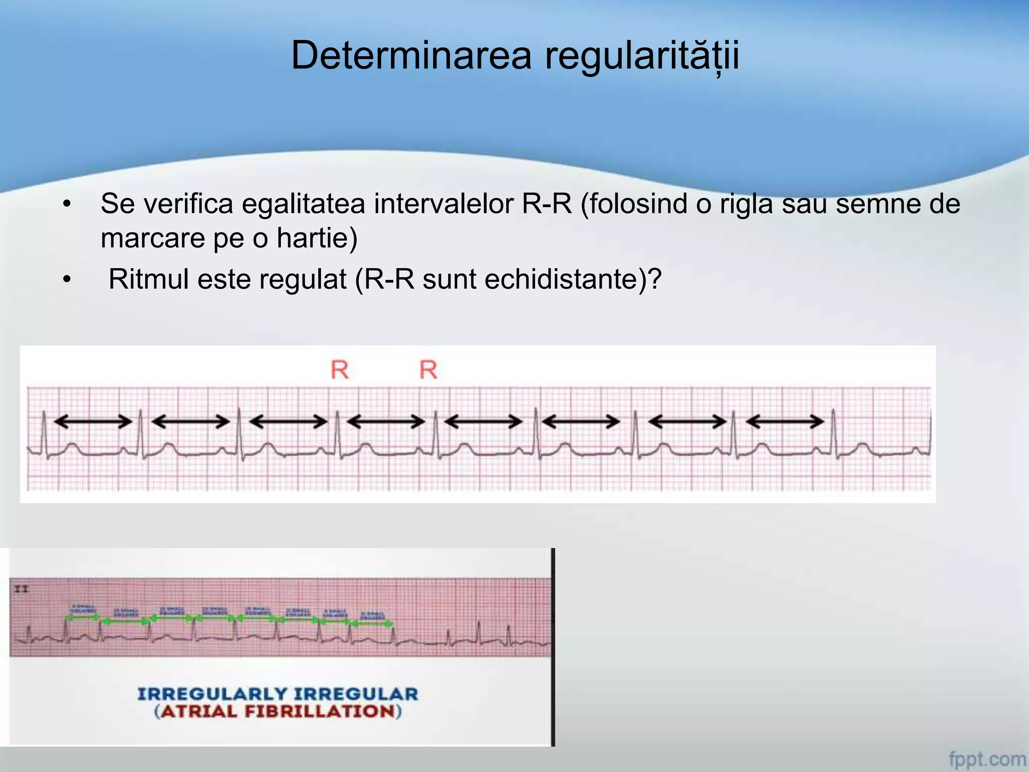 1094029 ekg interpretare.-hipertofia | PPT