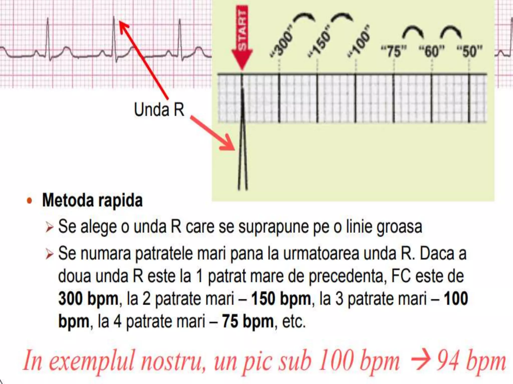 1094029 ekg interpretare.-hipertofia | PPT