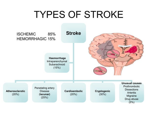109890management_stroke.ppt