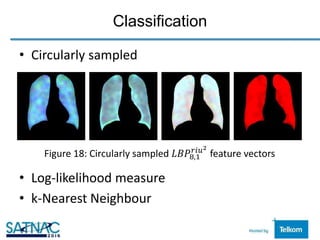 TB detection using modified Local Binary Pattern features | PPT