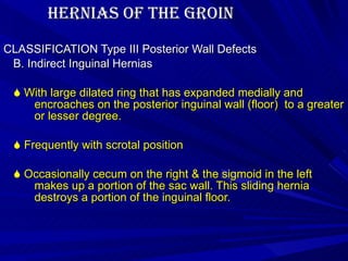 10 a.new groin hernias dr.fidel | PPT