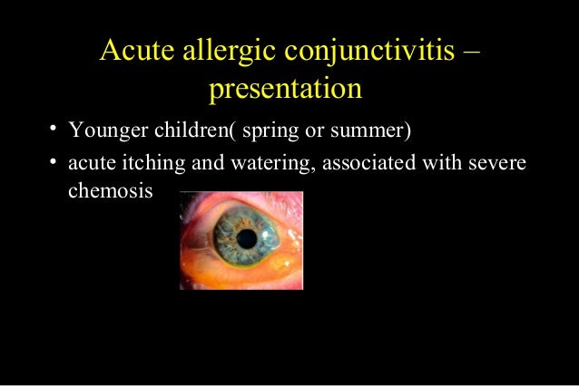 allergic conjunctivitis