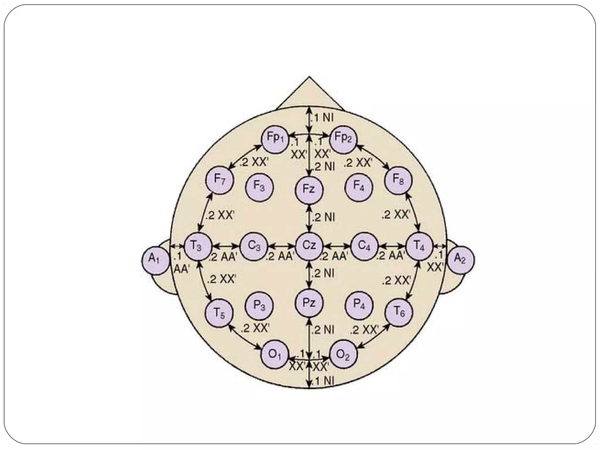 10 and 20 electrode placement | PPT