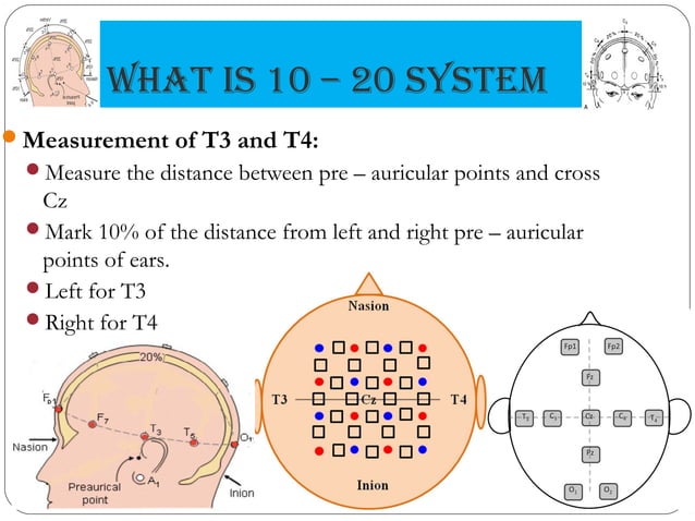 10 and 20 electrode placement | PPT | Brain and Nervous System ...