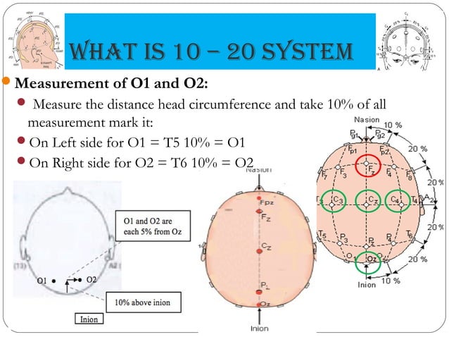 10 and 20 electrode placement | PPT | Brain and Nervous System ...