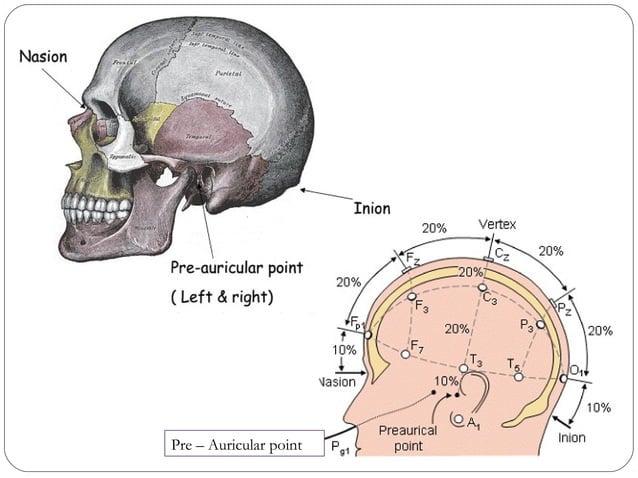 10 and 20 electrode placement | PPT | Brain and Nervous System ...